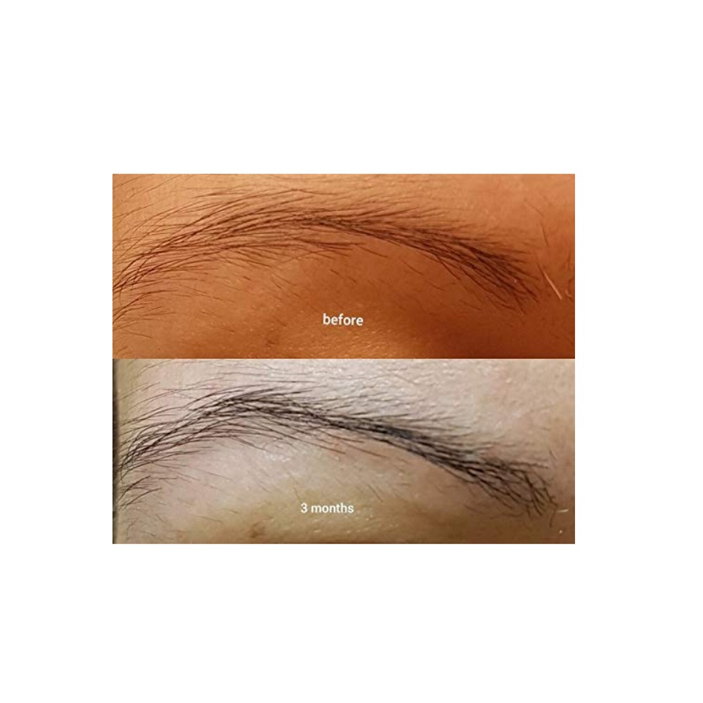 The Ordinary Multi-Peptide Serum for Hair Density 60ml | Sinin